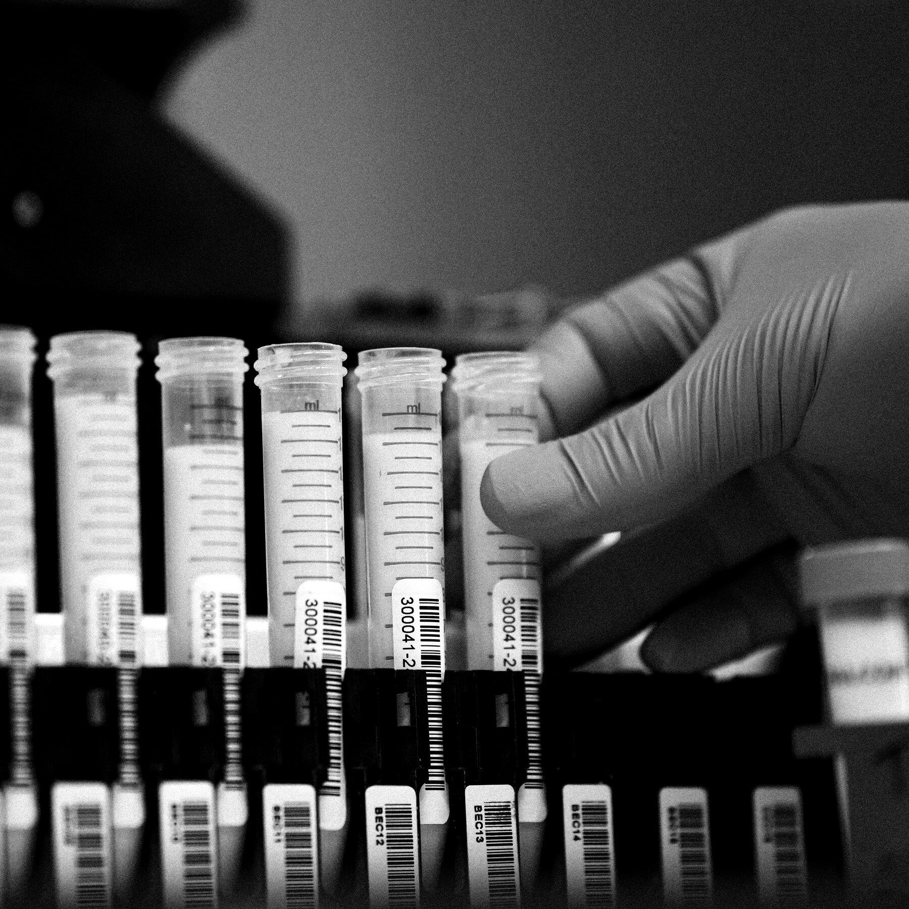 美国在禽流感上运气不错——至今为止 - 咕咕读